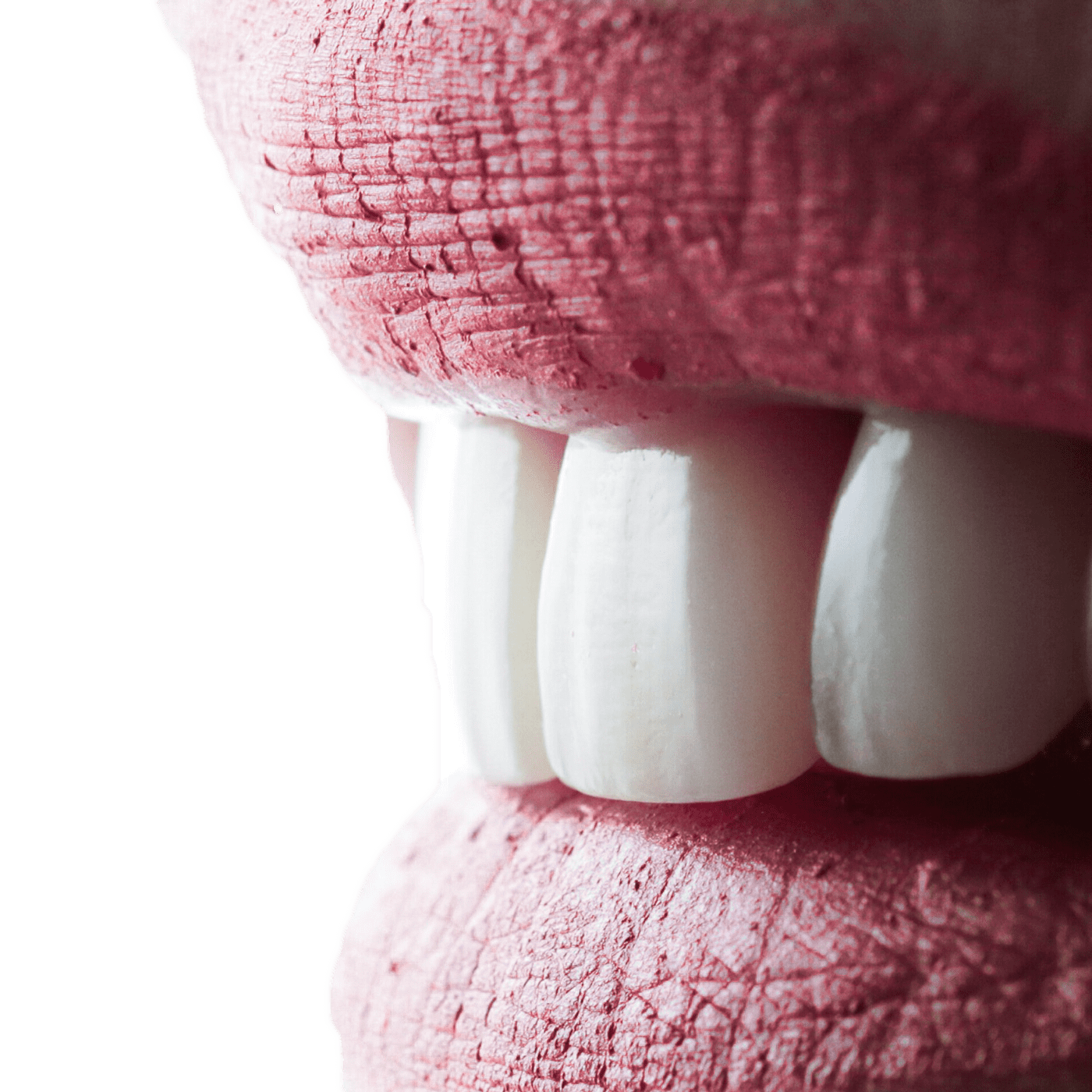 Emax® Crown – Dentetik | Dental Clinic in Istanbul / Turkey